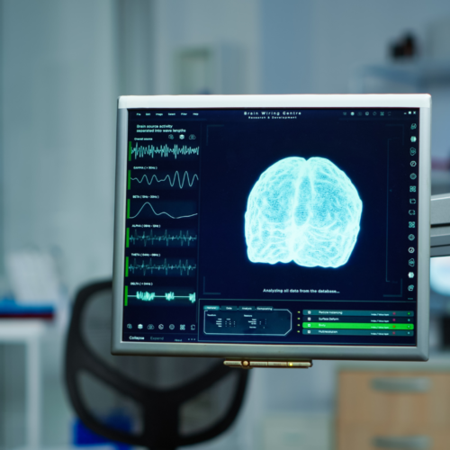 Machine Learning in Medical Imaging: Powering Diagnosis - AnuBrain